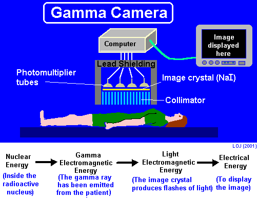 Gamma Camera History | The Evolution of Medical Imaging Technology